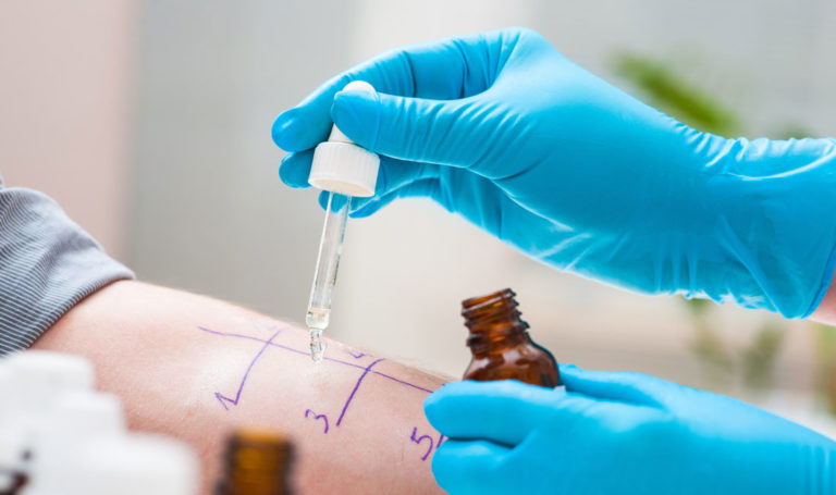 How to Prepare for Your Allergy Test - Useful Tips from AAOA